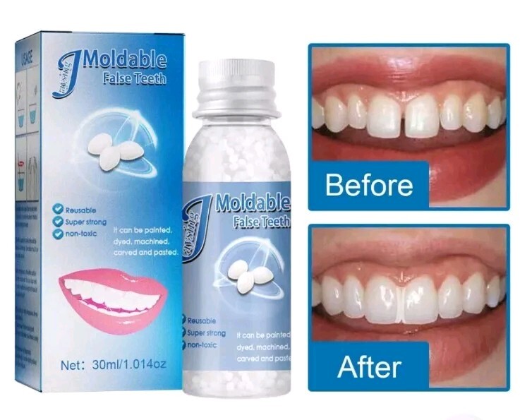 Resin False Teeth Solid Glue Temporary Tooth Gap Filler Tooth Repair ...
