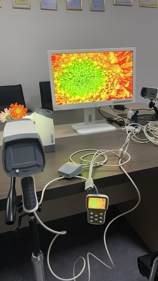 Digital Colposcope HD Video Camera System for Gynecological Cervical ...