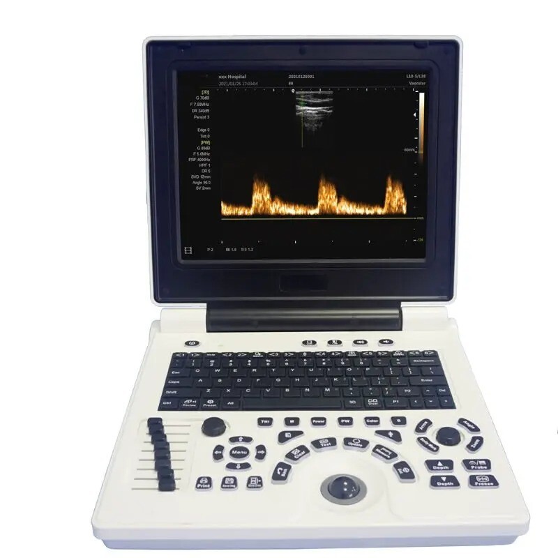 C2 12 Inch Laptop Ultrasound Machine Color Doppler Echo w/Convex Linear ...
