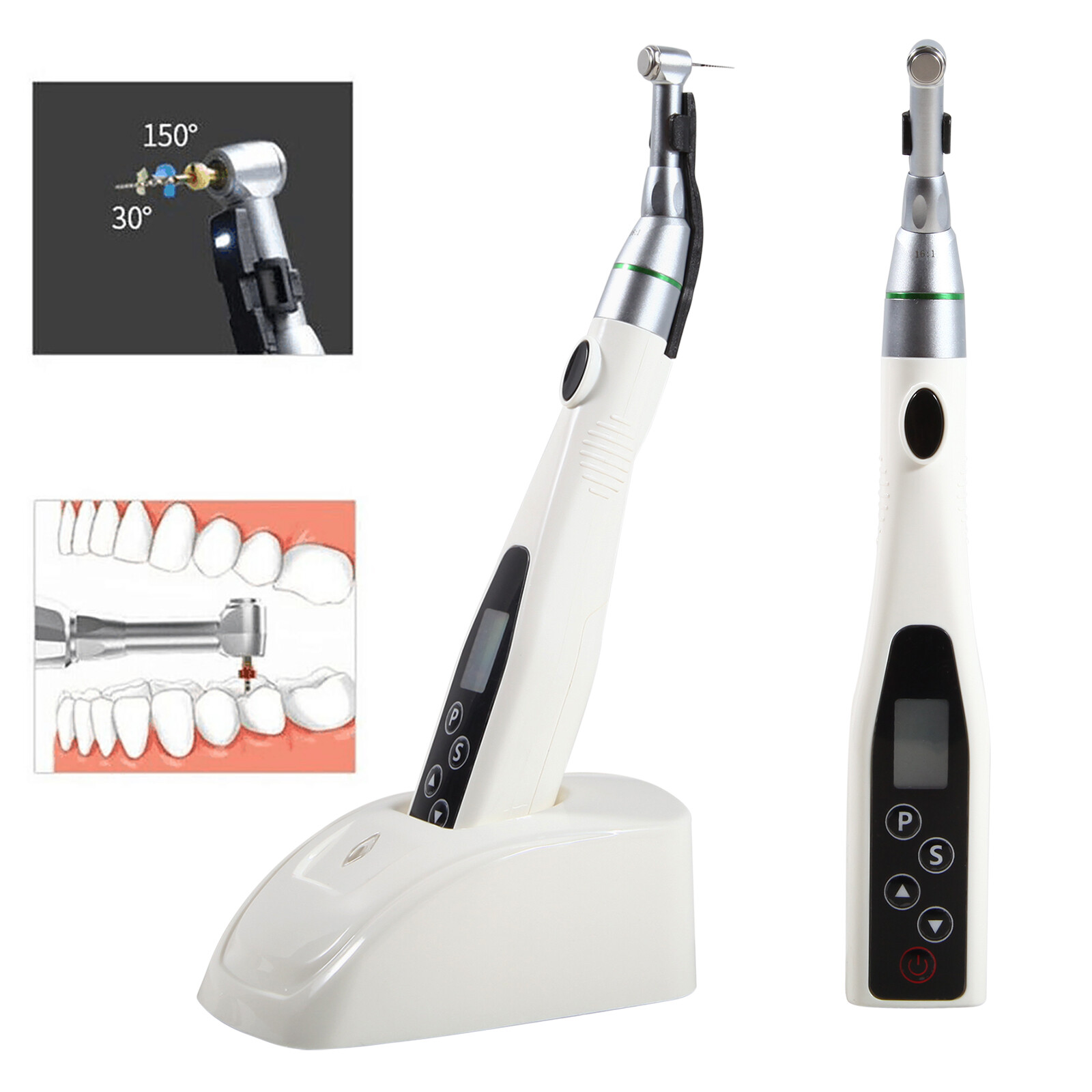 Wireless Dental LED Endo Motor 16:1 Contra Angle Handpiece Root Canal ...