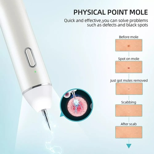 Laser Skin Tag Freckle Wart Dot Mole Remove Pen Dark Spot Tattoo ...