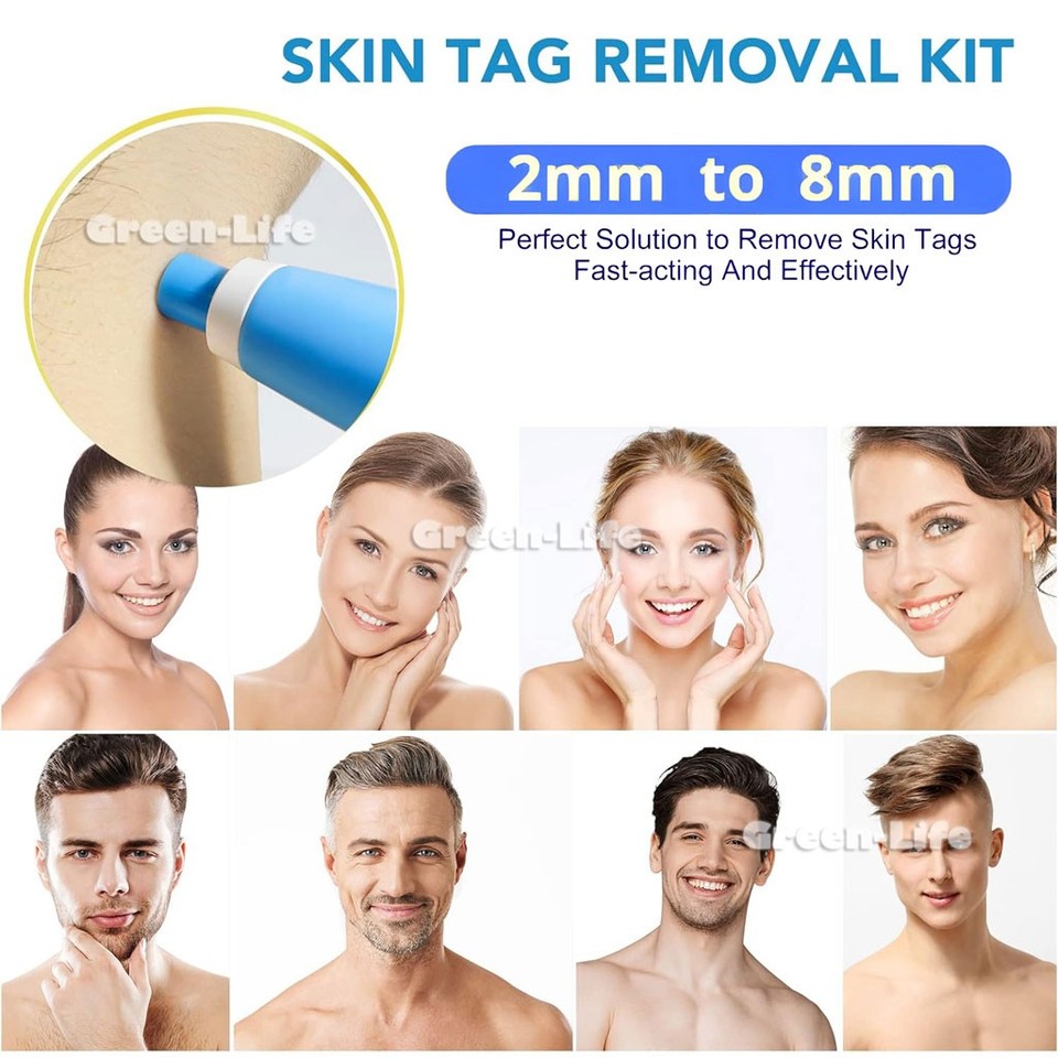2-in-1 Auto Micro Skin Tag Remover Device Portable Skin Tag Removal Kit ...