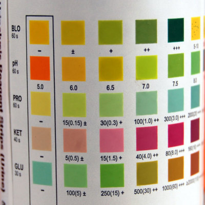 Urine pH Test Strips - Kidney Stone Risk Test - 10 Parameter - ALLTEST ...