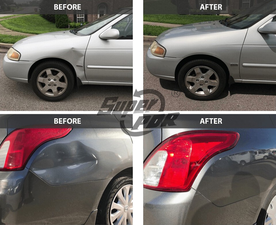 PDR Full Set Tool Dent Repair Kit Paintless Dent Removal Tools Dent ...