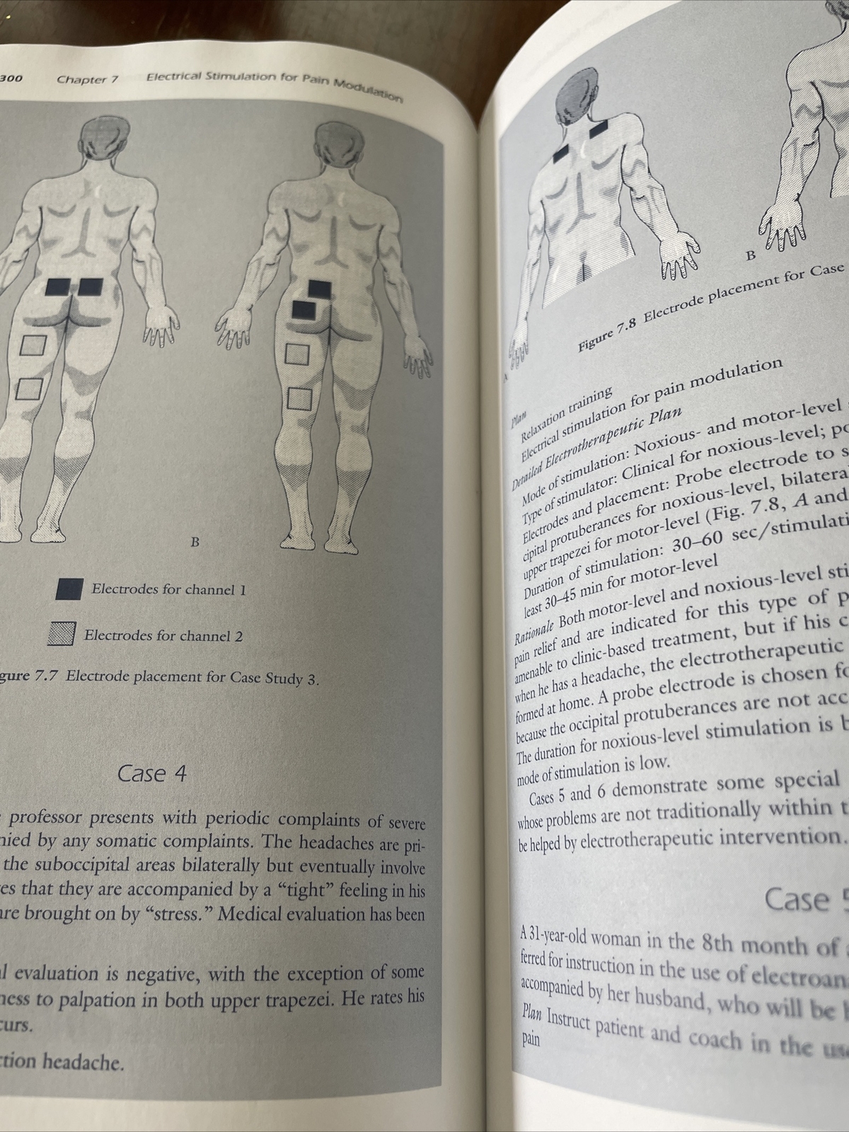 Clinical Electrophysiology by Andrew J. Robinson and Lynn Snyder ...