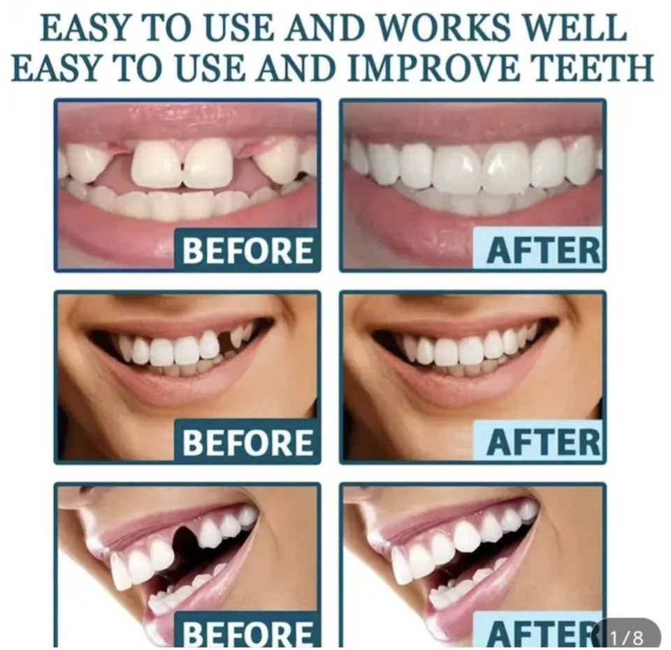 Retainers With Teeth, Affordable Way To Fill In Your Smile, with 1-3 ...