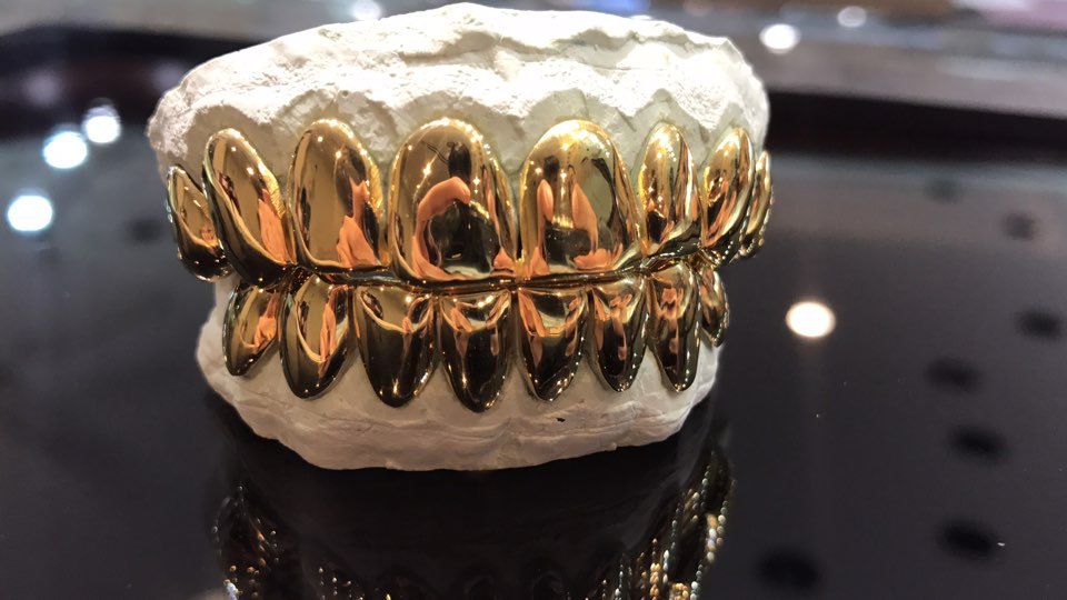 Sterling Silver W/ 18k Yellow Gold Plated Perm Cut Custom Fit Real ...