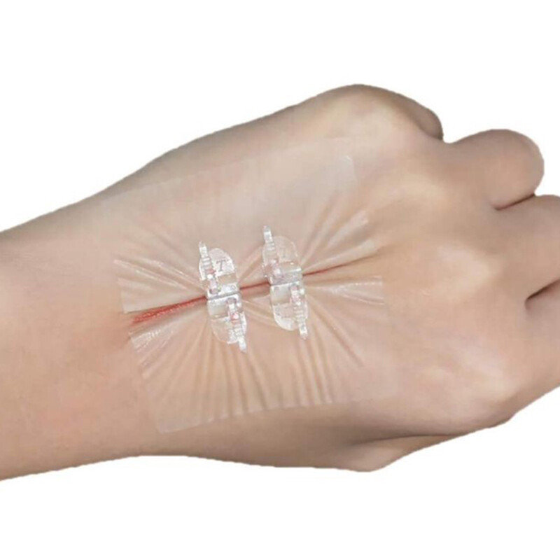 New Painless Suture Adhesive Wound Closure Wound Aid Patch Fast ...