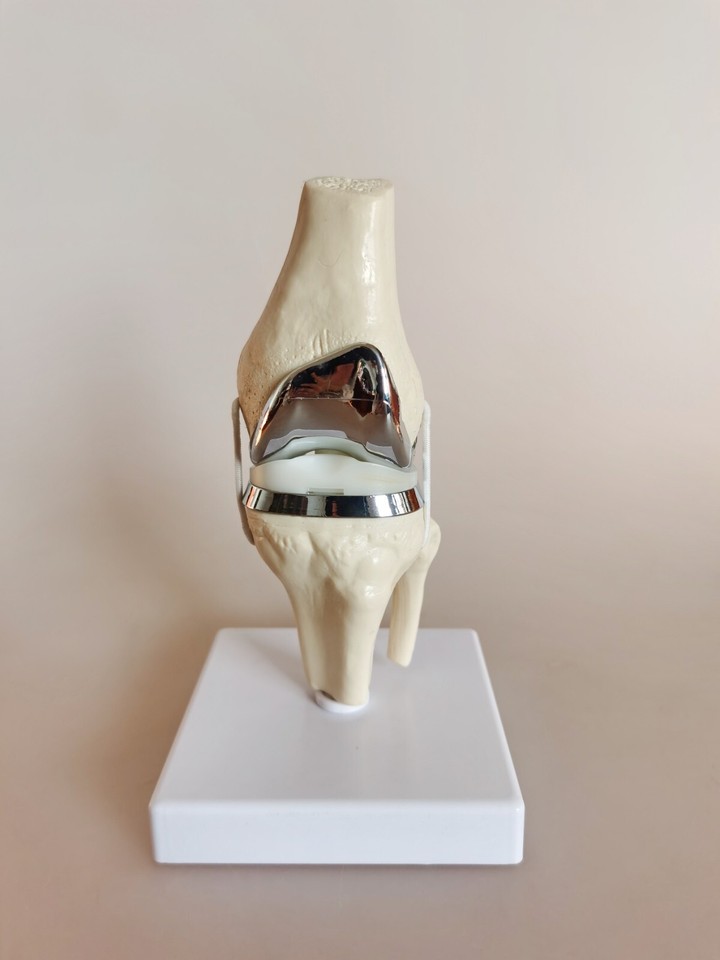 Detachable Artificial knee prosthesis Medical Anatomical Teaching demo ...