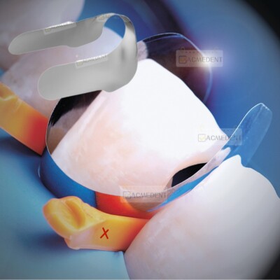 30/Box Dental Anterior Twin Matrices Cervical Matrix 1.523 Fits TOR VM ...