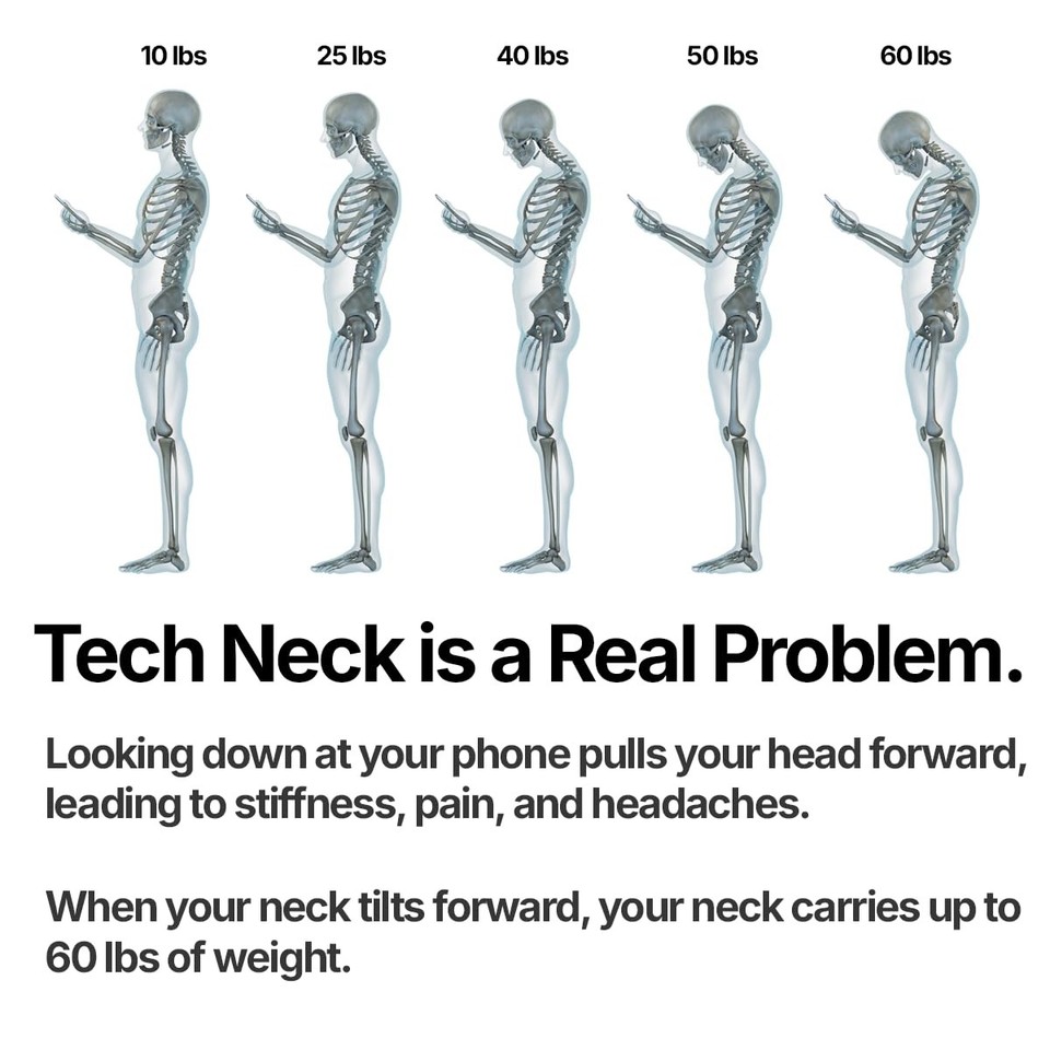Portable Neck Exercise Device - Neck Pain Relief, Posture Improvement ...