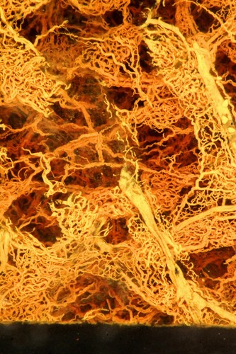 Antique microscope slide by Topping. Section of Human Skin. Injected ...