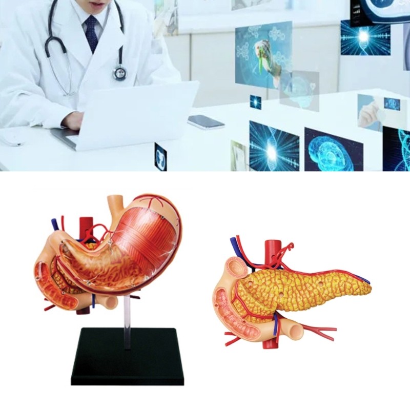 Human Stomach &Pancreas Anatomy Model Removable Human Organs Model ...