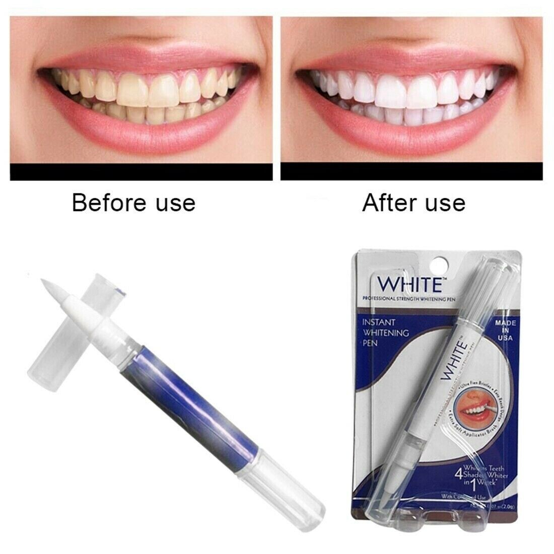 EXTRA STRONG TEETH TOOTH WHITENING GEL PEN WHITENER BLEACHING KIT ...