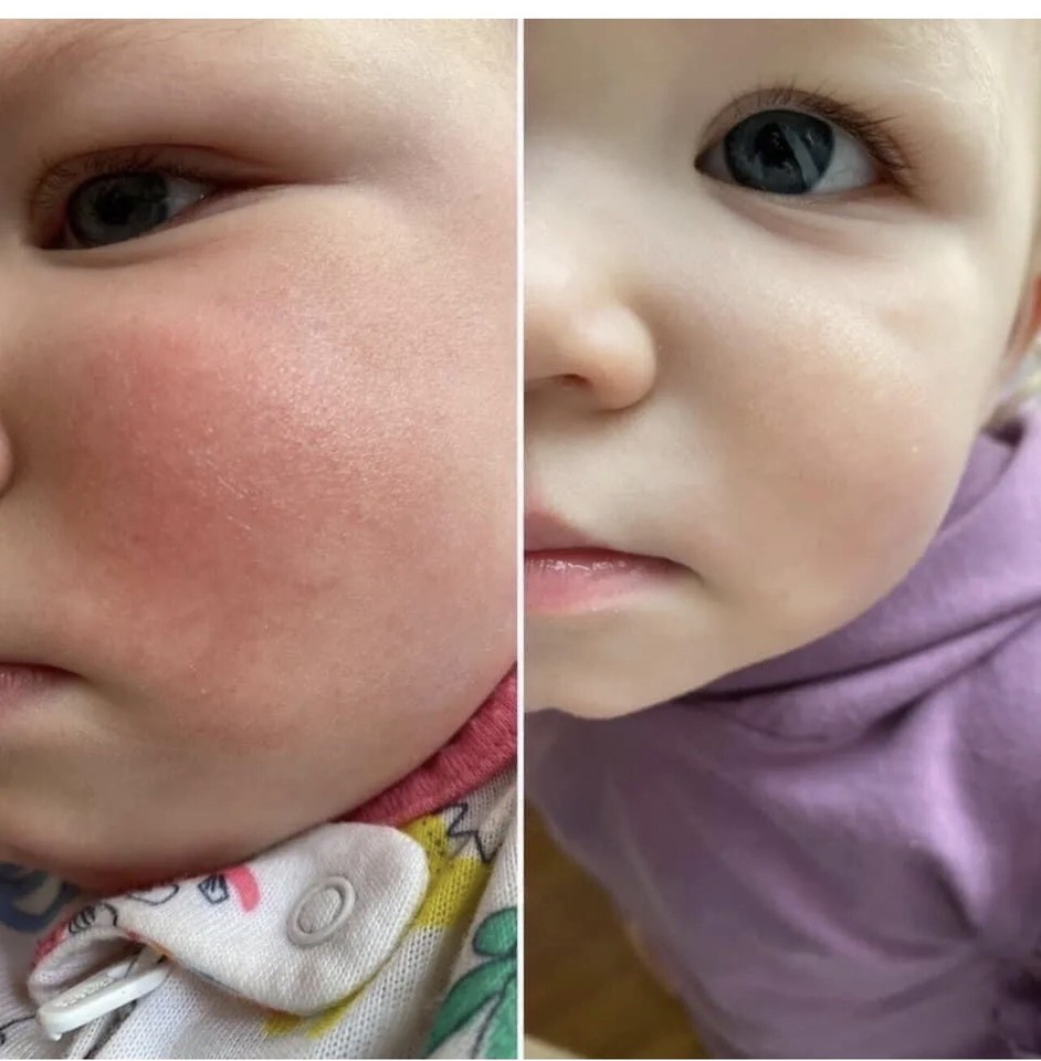 Epoch Baobab Body Butter Vanilla Cupcake🧁 Sunburn, Diaper Rash, Skin ...