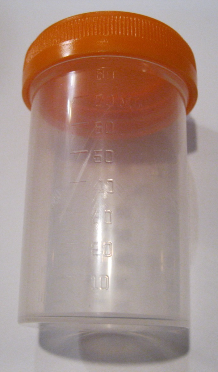 One Starplex Sterile Collection Sample Specimen Container 80mL Screw ...