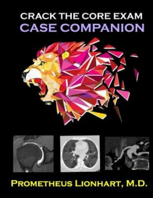 Crack the CORE Exam - Case Companion by Prometheus Lionhart M D: New ...