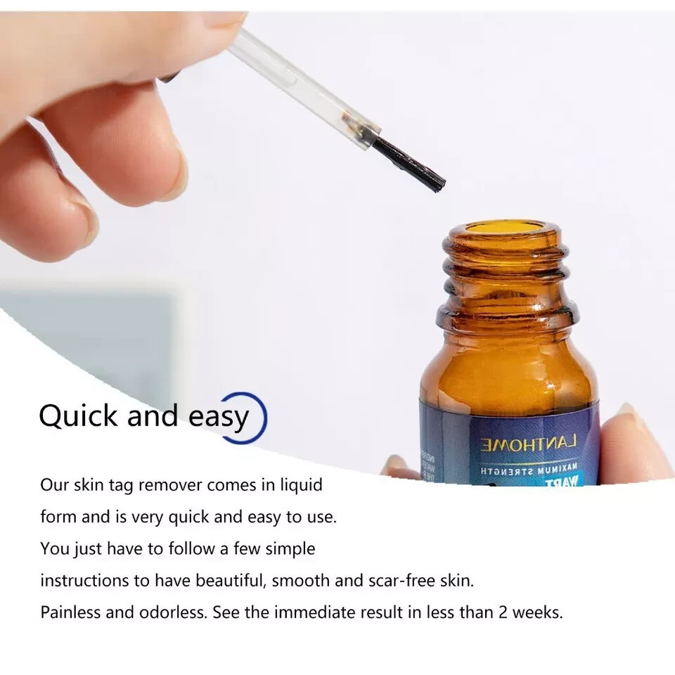 3 x bottles Mole Remover, Wart Remover, Skin Tag Remover, Colestrol ...