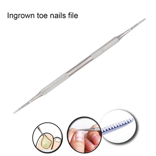Ingrown Toe Nail File Double Ended Side Edges - Blacks Chiropody ...