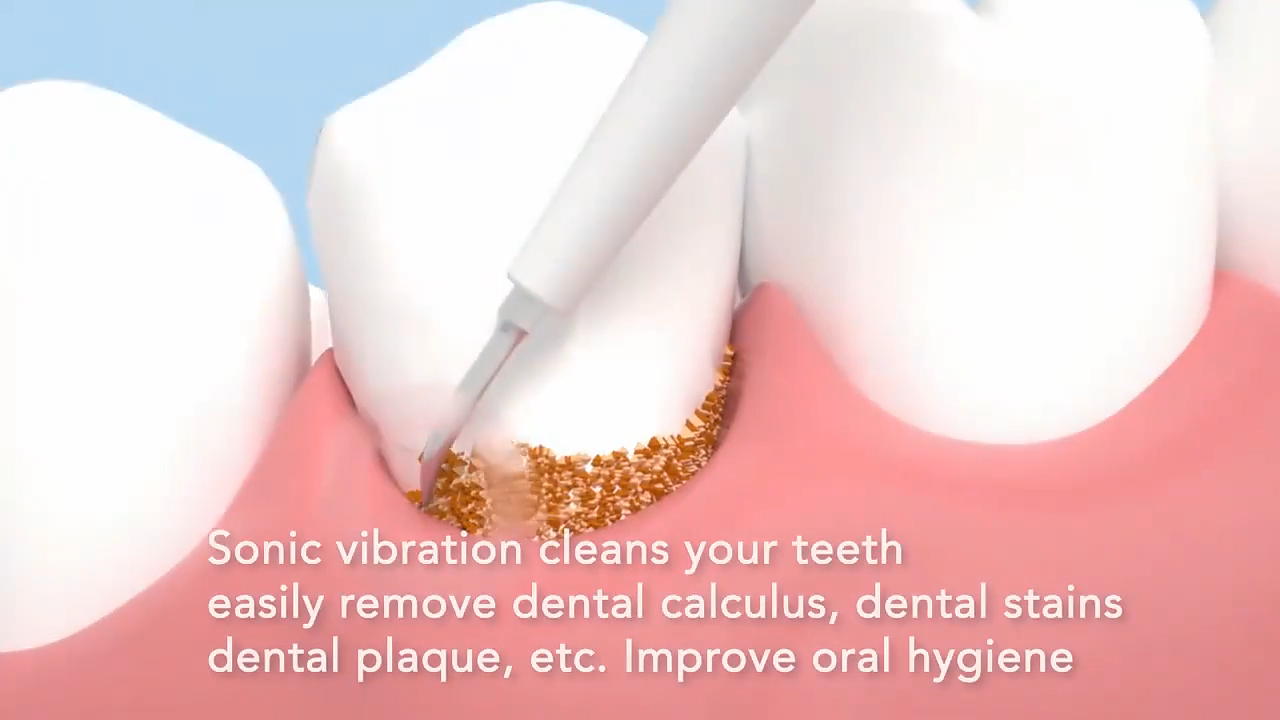 Ultraschall LED Scaler Zahnreinigung Anti Zahnstein Anti Plaque Tragbar ...