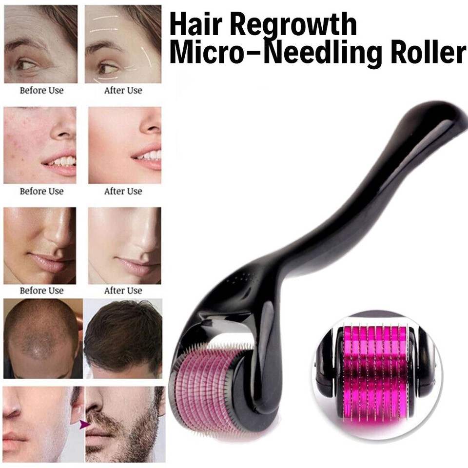 Derma Hair Regrowth Micro Needle Roller Beard Growth Product Anti Hair ...