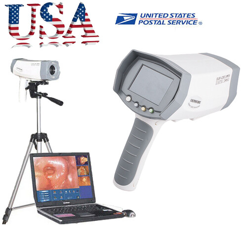480 000 Digital Video Electronic Colposcope Sony Camera Gynecology ...