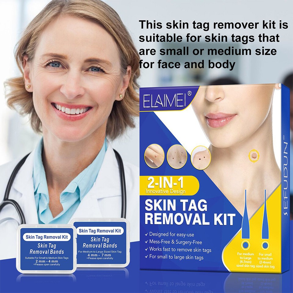 2 in 1 Natural Painless Auto Skin Tag Removal kit Skin tag bands ...
