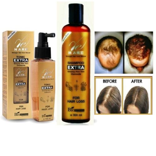 BIO WOMAN Hair Loss Shampoo Tonic Extra Strength Fast Growth New Regrow ...