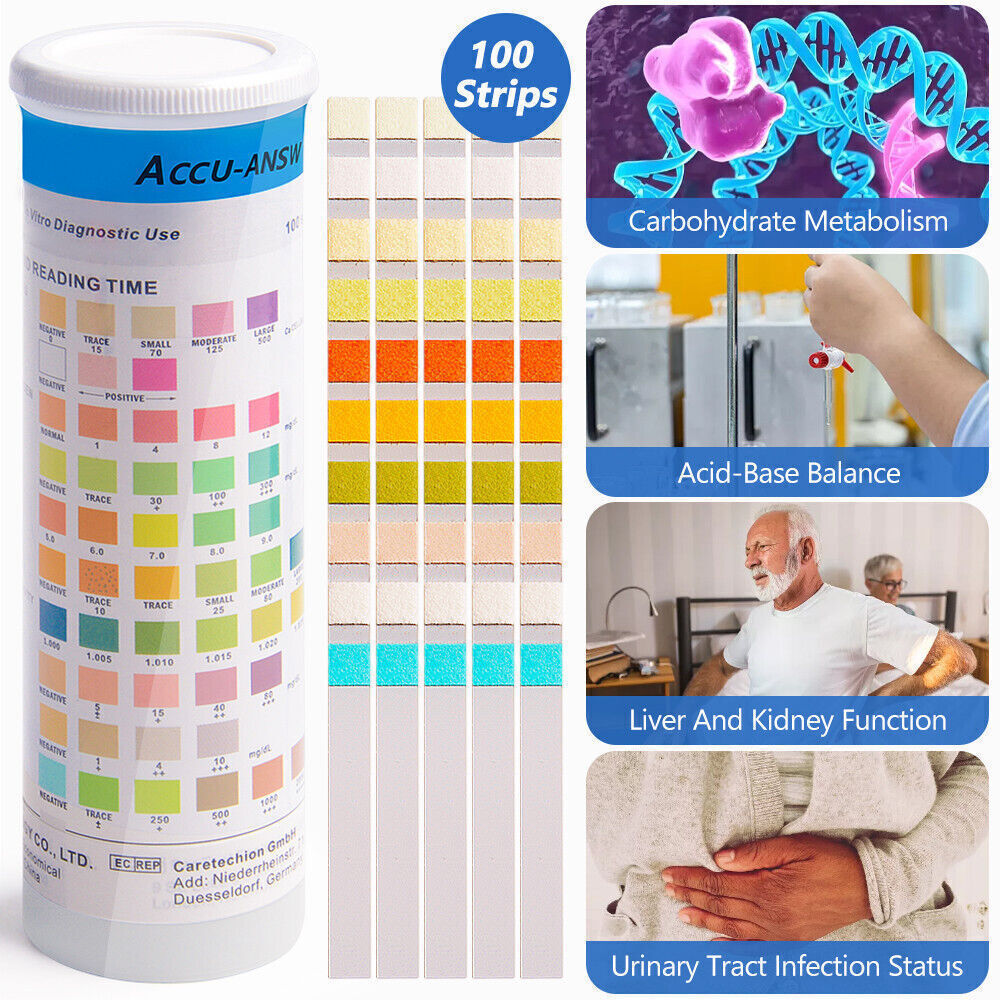 100 x Accu-ANSWER 10 Parameter Urine Test Strips 10-in-1 Urinalysis ...