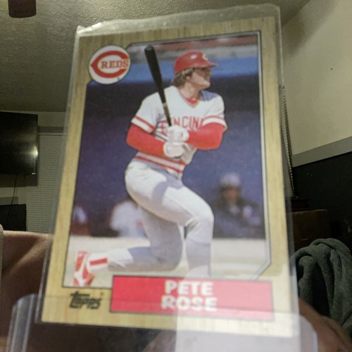 1987 Topps - #200 Pete Rose - Rare Error Card with Pink | eBay