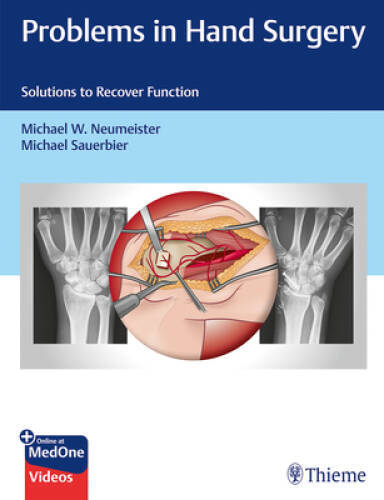 Problems in Hand Surgery (Solutions to Recover Function) - Hardcover - VERY GOOD 9781626237094| eBay