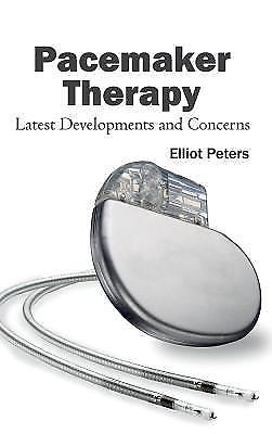 Pacemaker Therapy: Latest Developments and Concerns by Elliot Peters ...