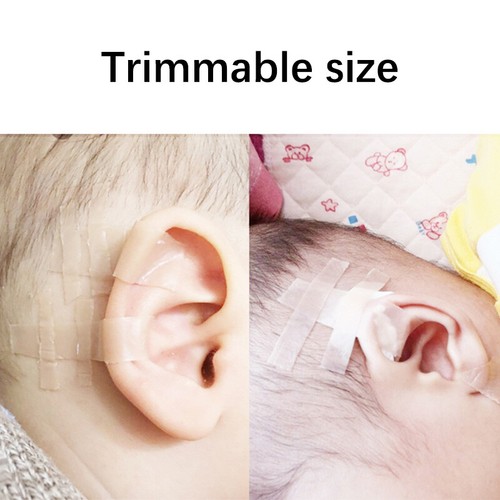 Ear Aesthetic Correctors Newborn Baby Ear Patch Stickers Kids Infant ...