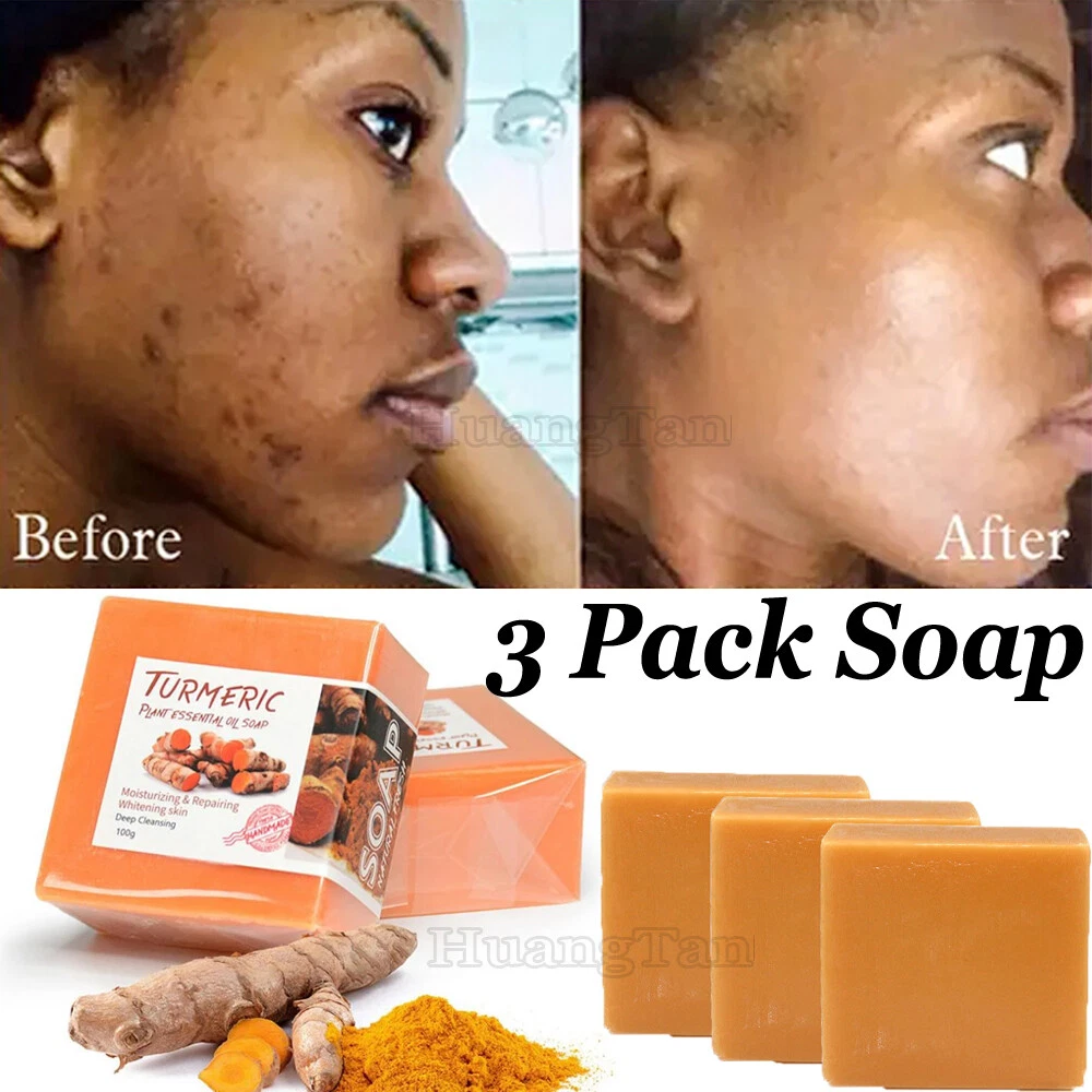 Bleaching Soap Before And After