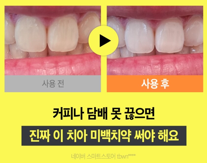 BRIALL Pure Premium Whitening Toothpaste 120g Korea No.1 whitening ...