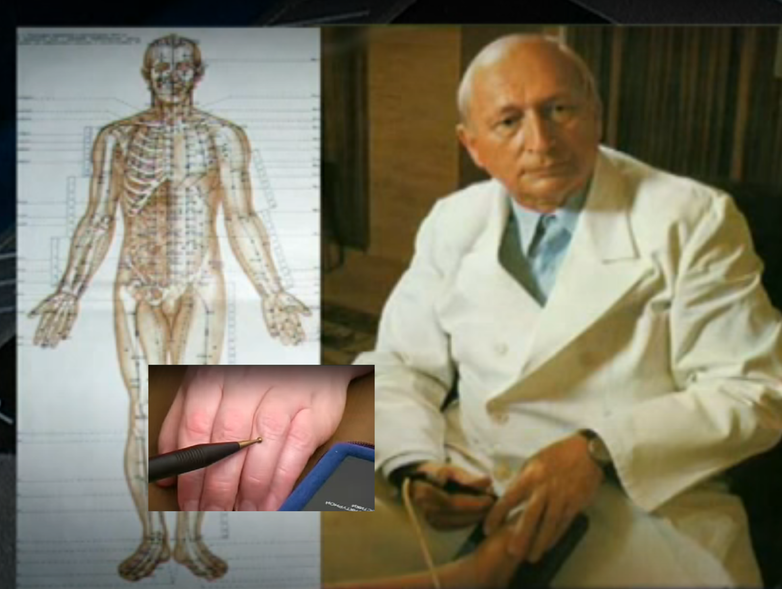 DEKA VOLL EAV unit acupuncture health diagnostic homeopathy test diet ...