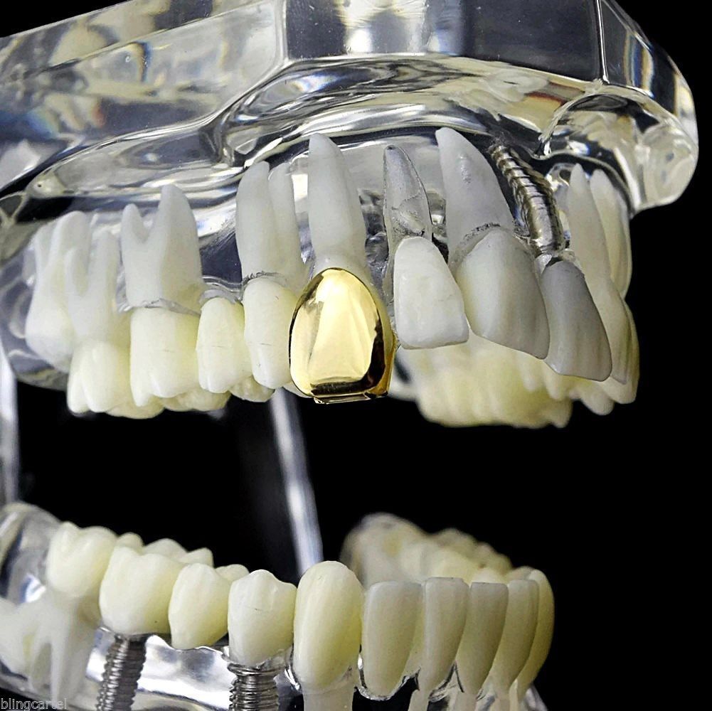 14k Gold Plated Single Cap Grillz Plain K9 Canine Teeth One Top Premade ...