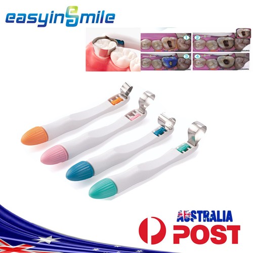 Dental Pro Matrix Band Pre Form 4.5/6MM Curved Standard Restoration ...