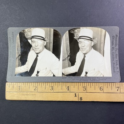 Man With Bullet Wound In Head Stereoview Shot In Eye Eyepatch Antique ...
