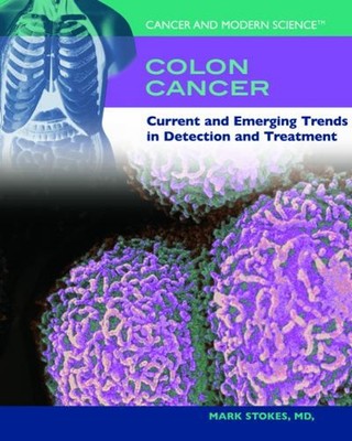 Colon Cancer : Current and Emerging Trends in Detection and Treat ...