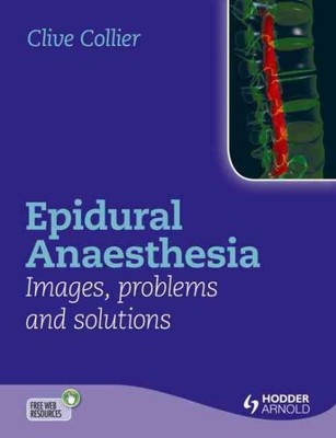 Epidural Anaesthesia : Images, Problems and Solutions, Hardcover by ...