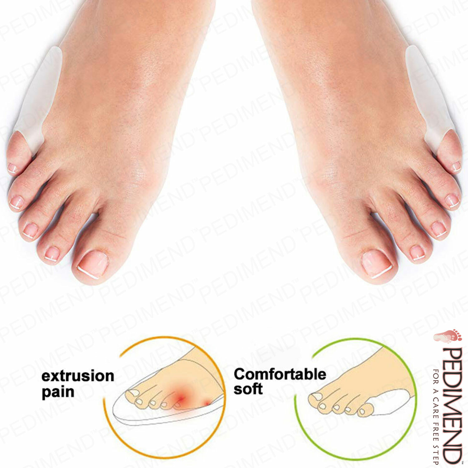 Bunionette Tailors Toe Little Toe Bunion Pain Relief Protector (2PC ...