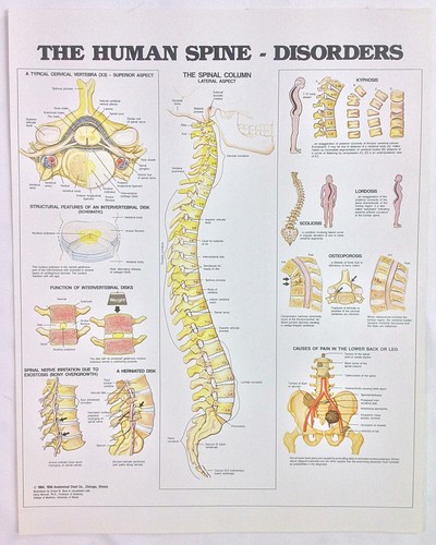 Vintage The Anatomical Chart Series Book Print 1988 The Human Spine ...