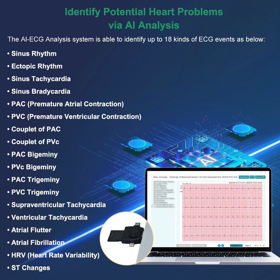 Livenpace 12 lead Dynamic ECG EKG Holter Recorder 24 Hours PC AI ...
