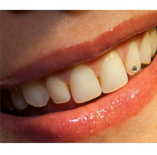 Zahnschmuck Steine ⚡ hergestellt mit Swarovski Elements ♥ viele Farben♥ ...