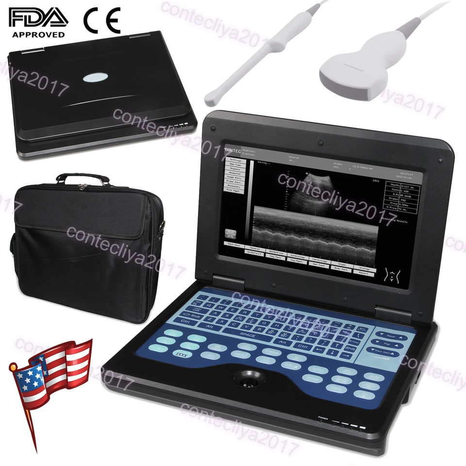 Laptop Ultrasound Scanner Machine Convex/Linear/Cardiac/Tranvaginal ...