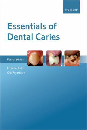 Essentials of Dental Caries, Paperback by Kidd, Edwina; Fejerskov, Ole ...