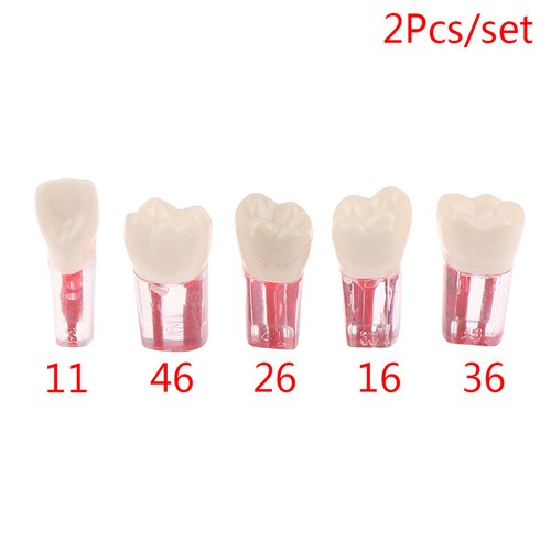 2Pcs Resin Dental Endodontic Tooth Model Endo Root Canal Files Pulp ...