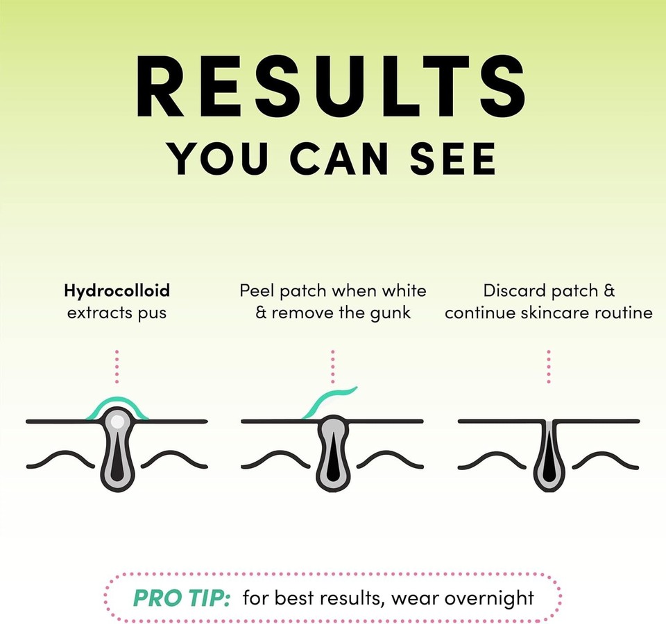 Dots for Spots Acne Patches Pack of 24 Translucent Hydrocolloid Pimple ...