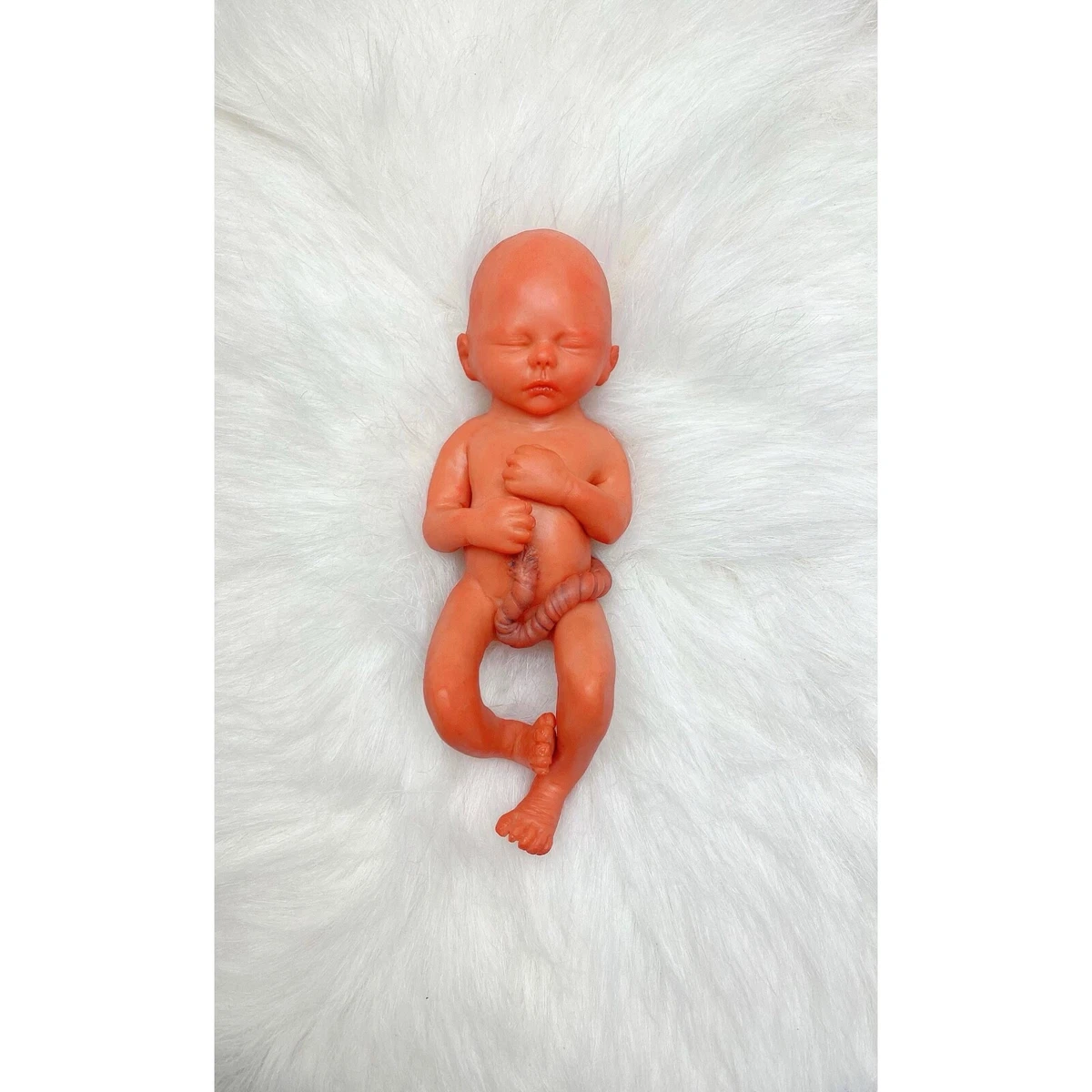 Miscarried Fetus At 18 Weeks